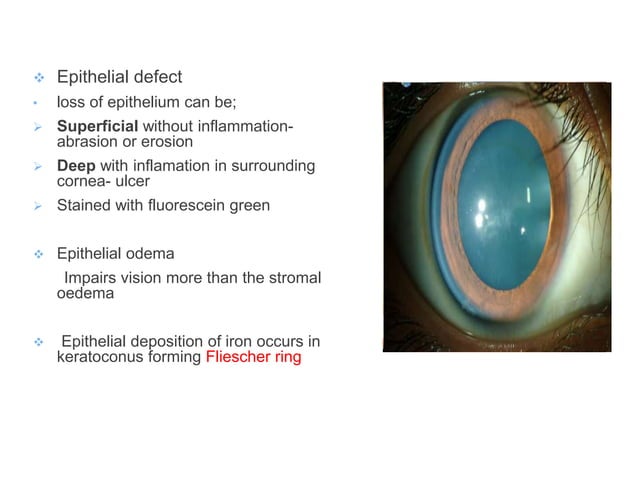 Ophthalmology anatomy of cornea Final.ppt