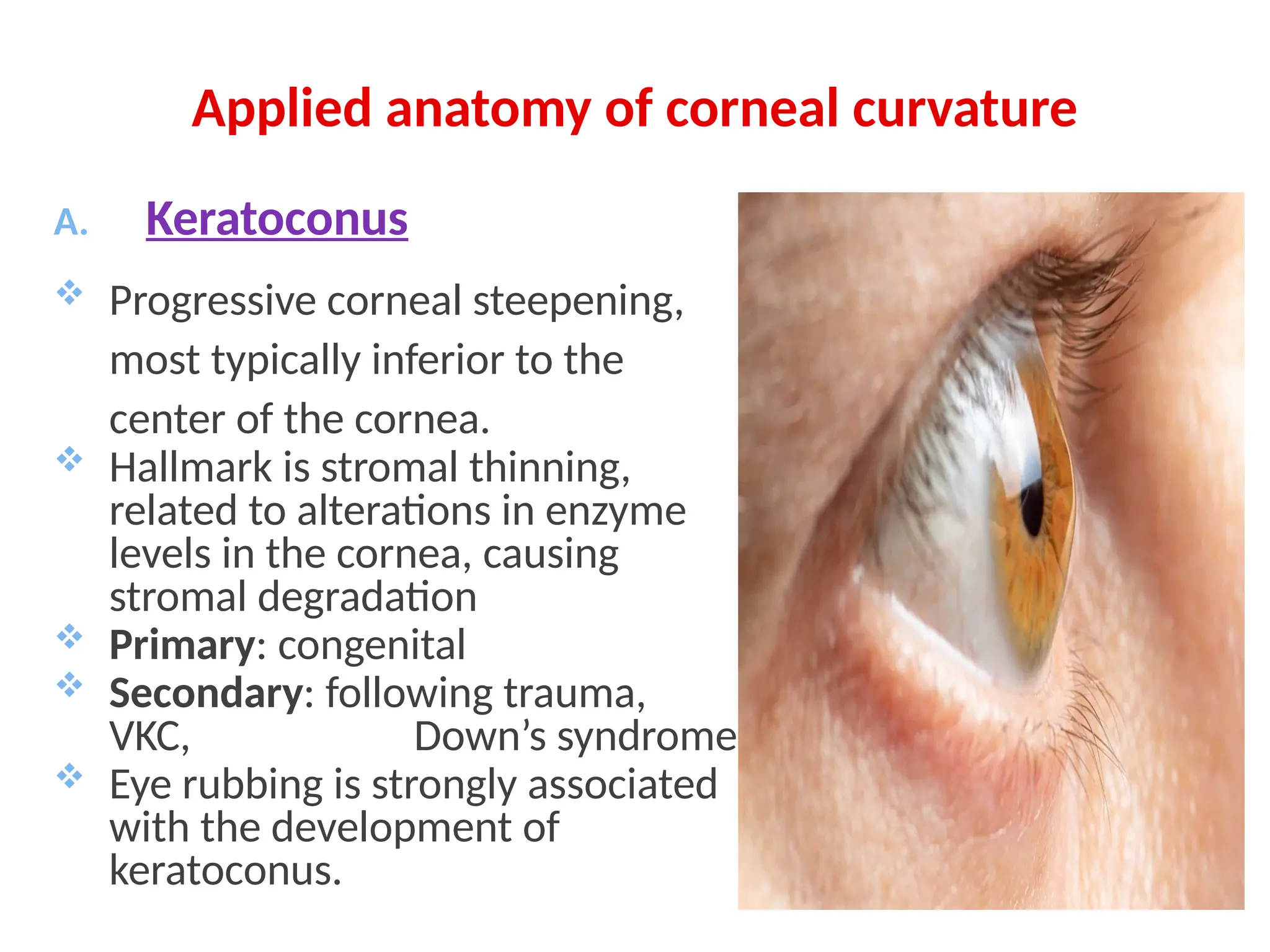 7 anatomy of cornea Final of ophthalmology.ppt