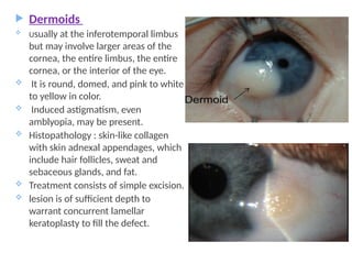 7 anatomy of cornea Final of ophthalmology.ppt