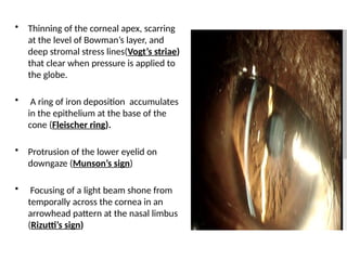 7 anatomy of cornea Final of ophthalmology.ppt