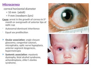 7 anatomy of cornea Final of ophthalmology.ppt