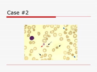 7 Anemia full lecture notes for preparing exam | PDF