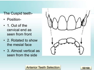anterior teeth selection | PPTX