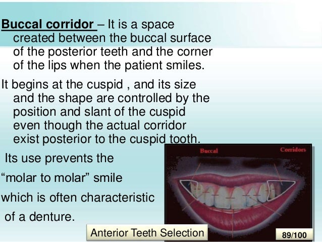 anterior teeth selection
