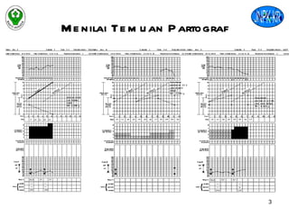 7a persalinan abnormal | PPT