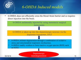screening model for parkinsons disease | PPT