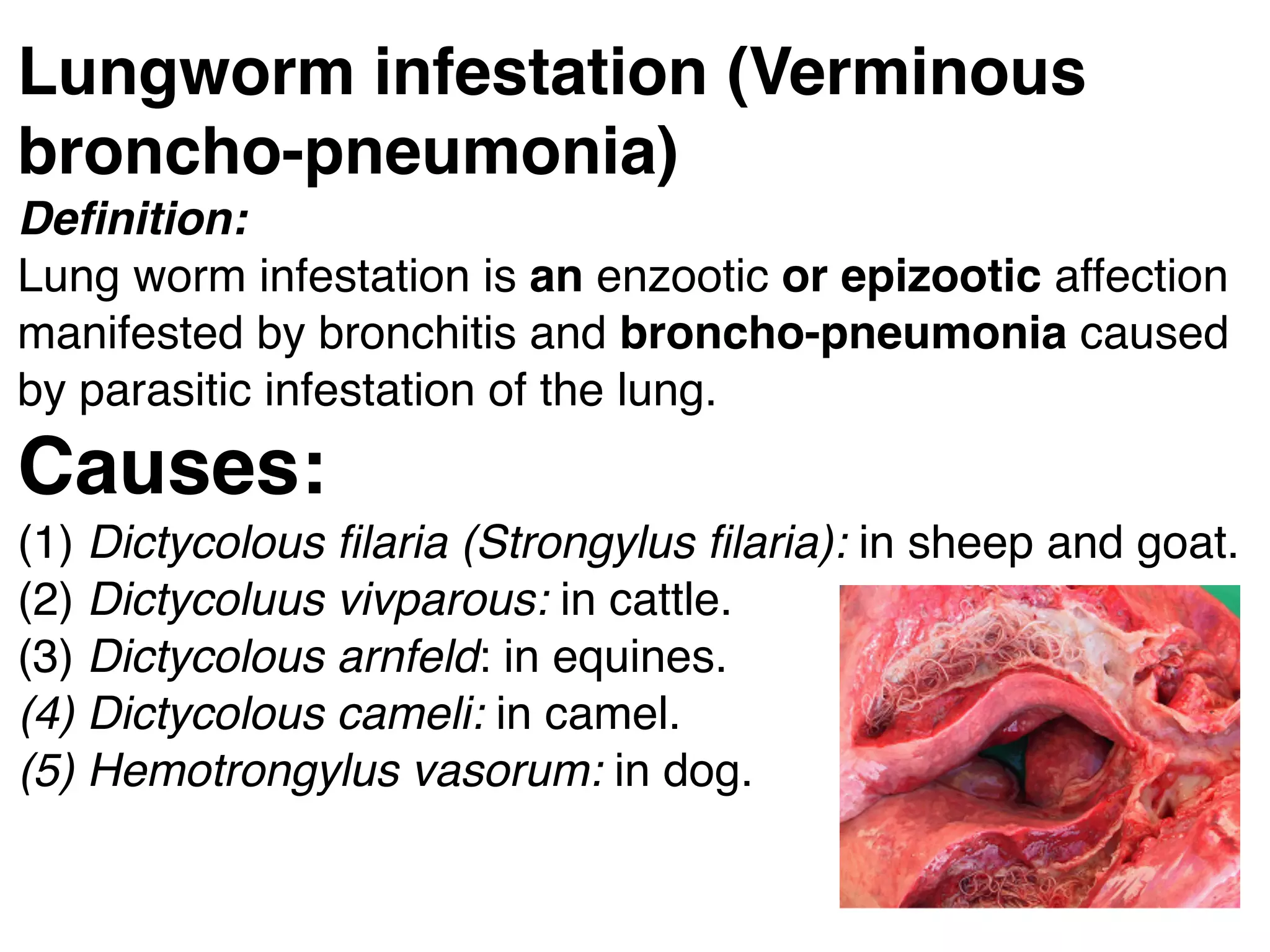 7 aspiration pneumonia | PDF