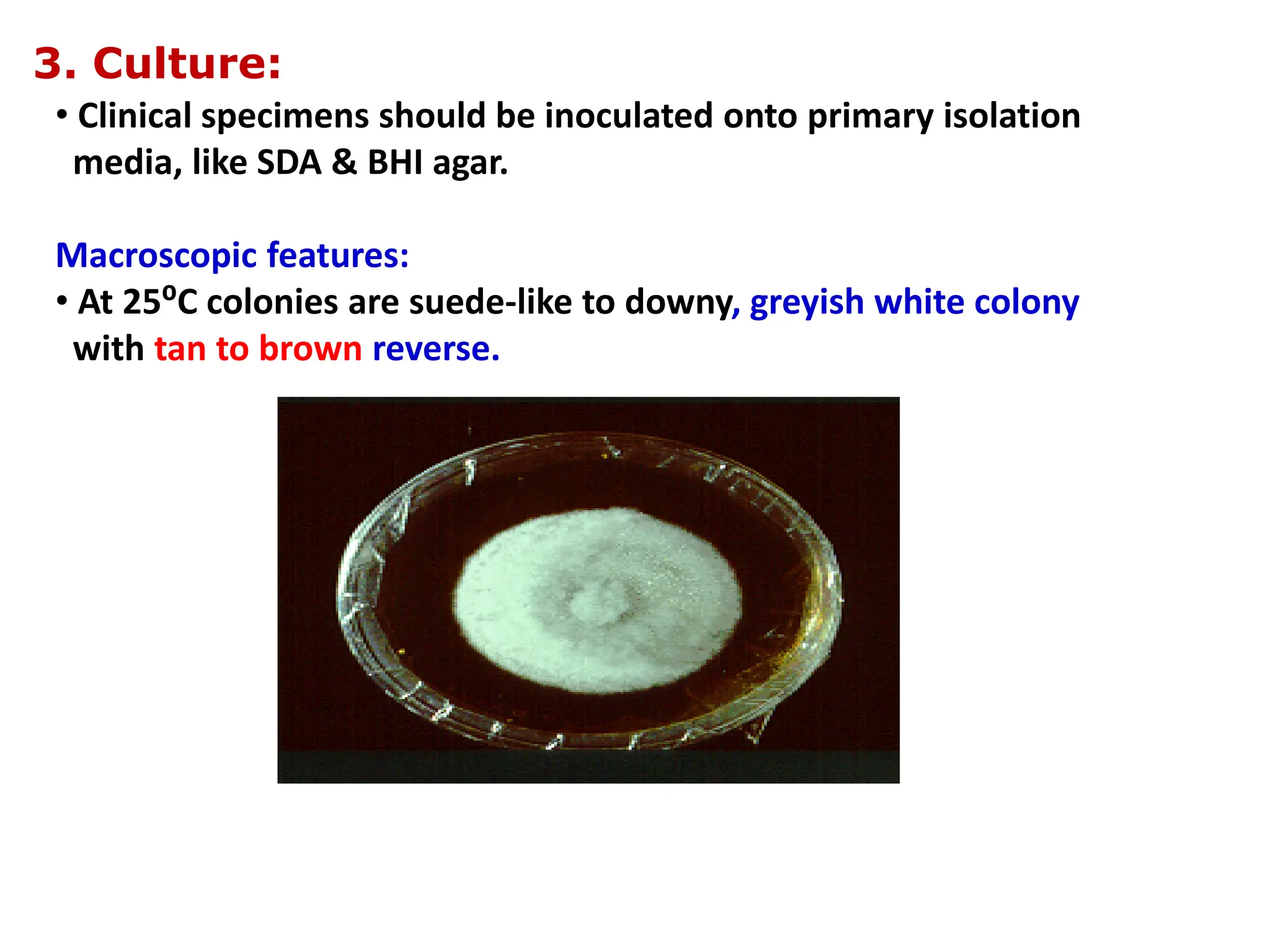 Coccidioidomycosis and Paracoccidioidomycosis | PDF