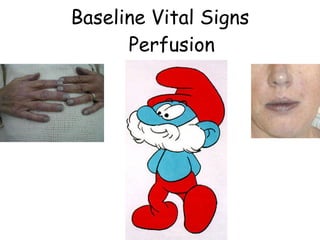 7)Baseline Vital Signs And Sample History | PPT