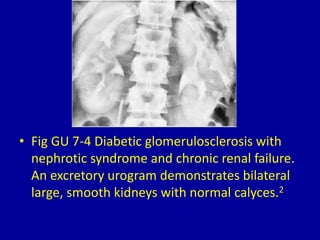7 bilateral large, smooth kidneys | PPTX