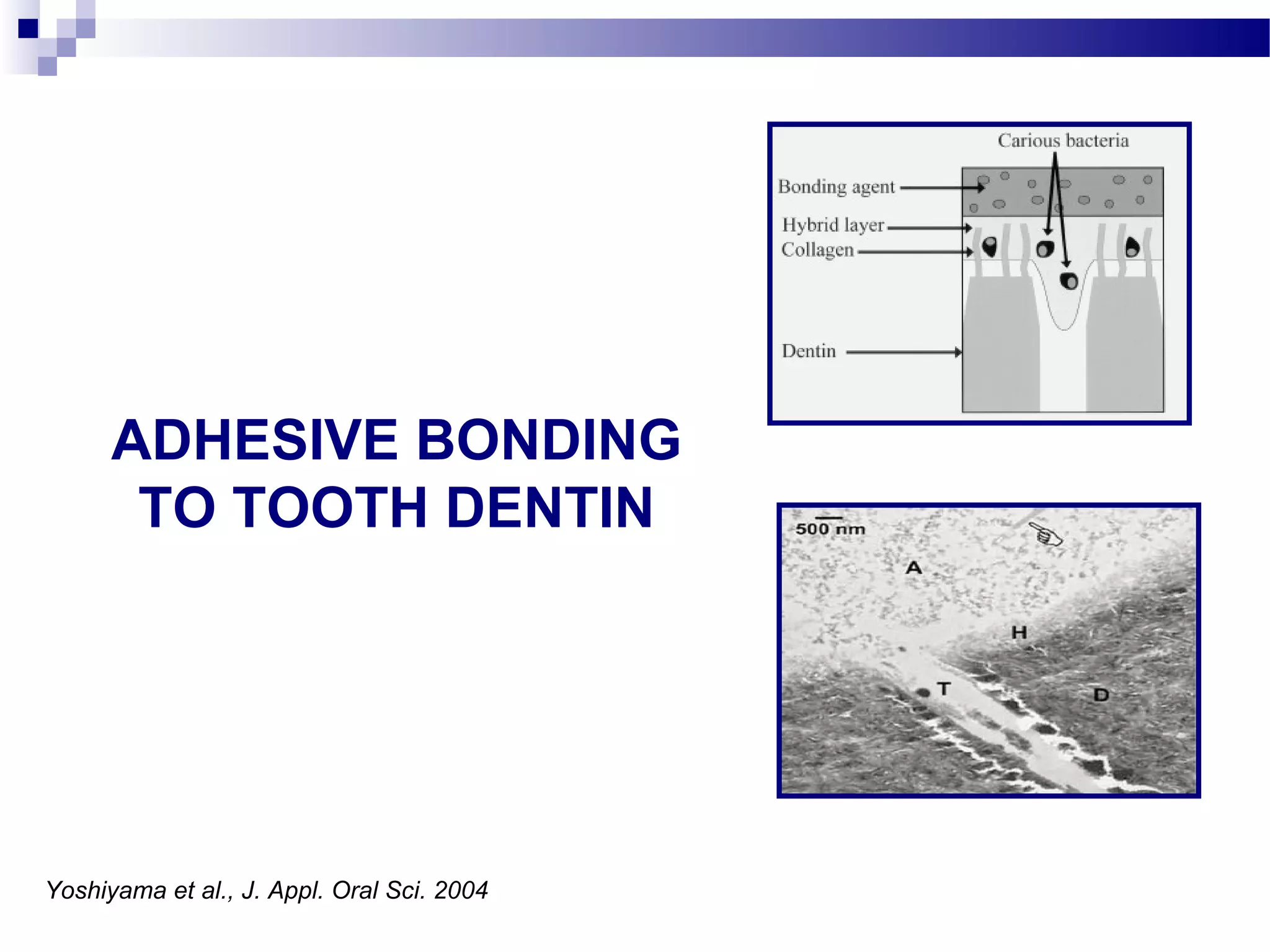 bonding to tooth structure dental material | PPS
