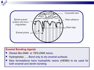 bonding to tooth structure dental material | PPS