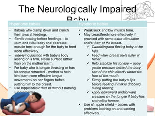 7 breastfeeding the premature and the sick term baby | PPTX