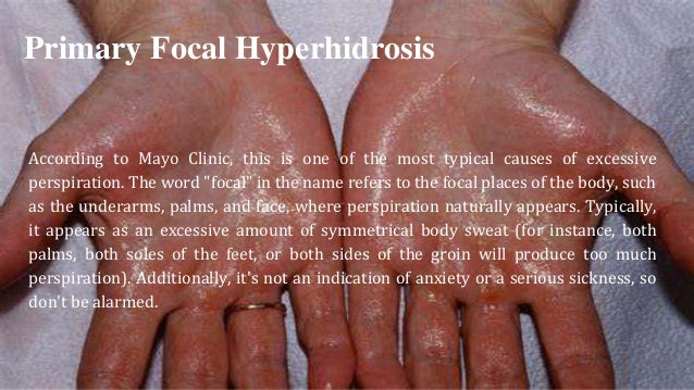 7 Causes of Excessive Sweating | PPT