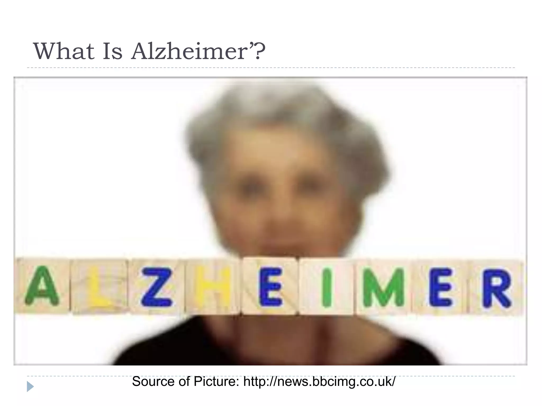 Alzheimer Disease | PPT