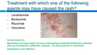 Hematologic Malignancies: Approach to Understanding Pathogenesis and ...