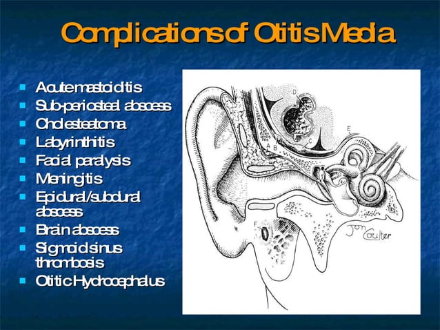 7 chronic suppurative otitis media with and without cholesteatoma | PPT