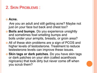 7 classical symptoms of pcos by dr.shailesh phalle | PPT