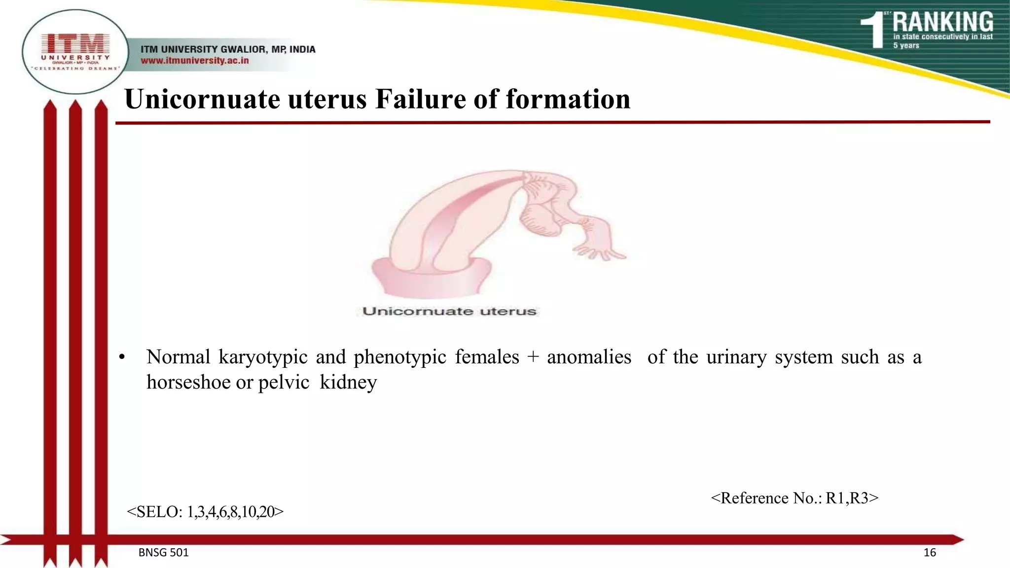 7 CONGENITAL ANAMOLIES OF UTERS AND CERVIX.pptx