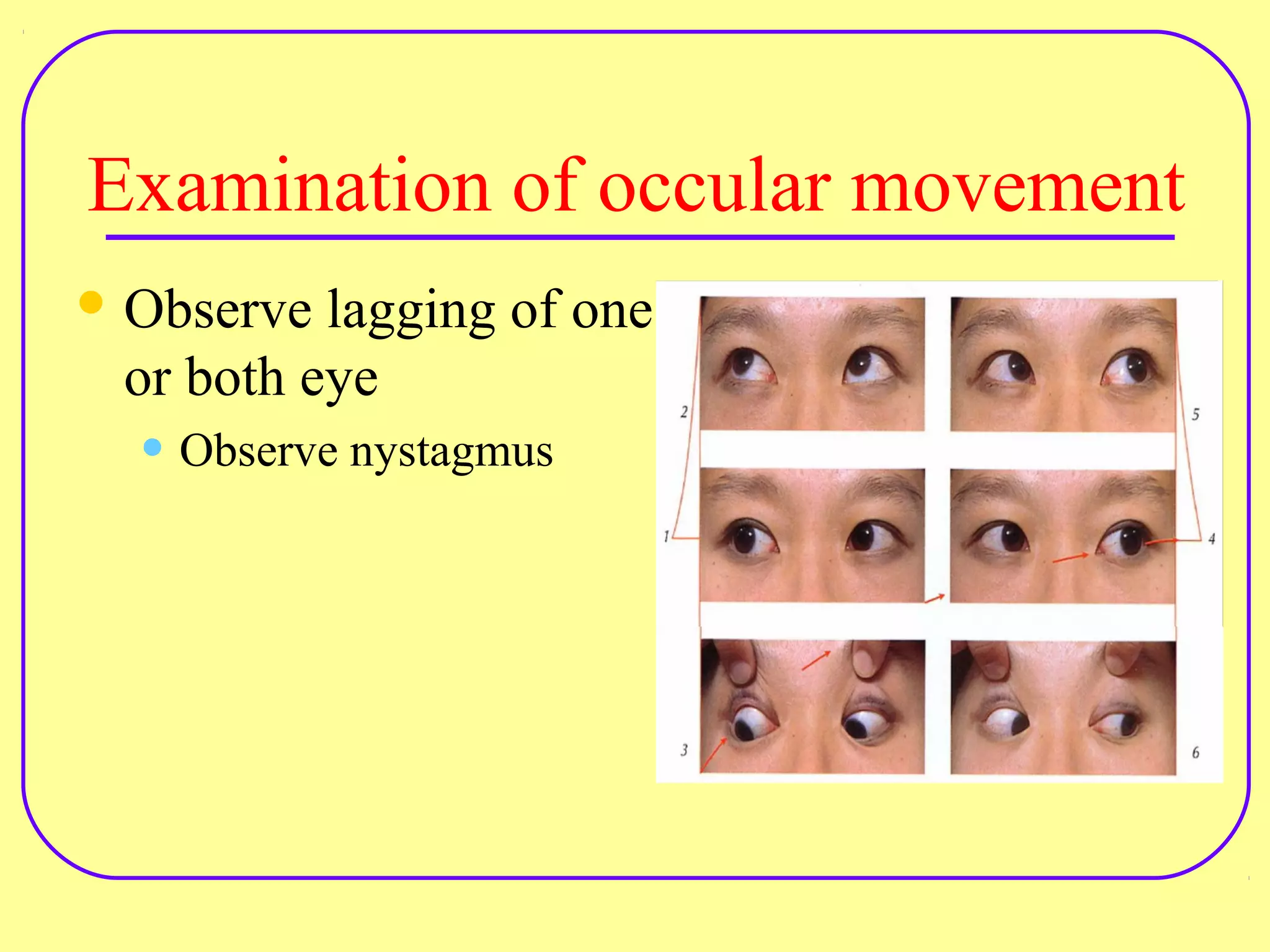 Cranial nerve examination | PPT