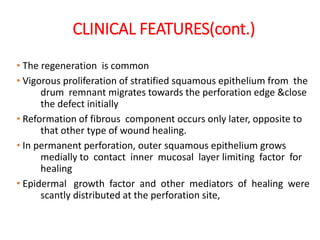 CHRONIC SUPPURATIVE OTITIS MEDIA (TUBOTYMPANIC) | PPT