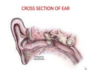 CHRONIC SUPPURATIVE OTITIS MEDIA (TUBOTYMPANIC) | PPT
