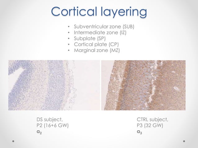 Spatial and temporal distribution of gabaa in cortical parts | PPT