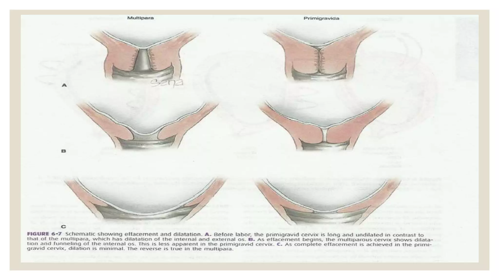 CAUSES AND ONSET OF NORMAL LABOUR | PPTX