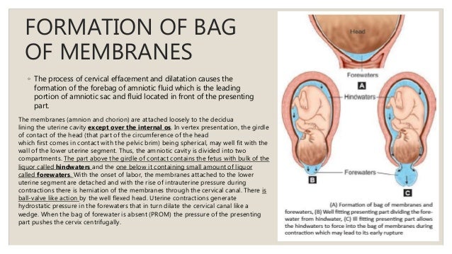 CAUSES AND ONSET OF NORMAL LABOUR