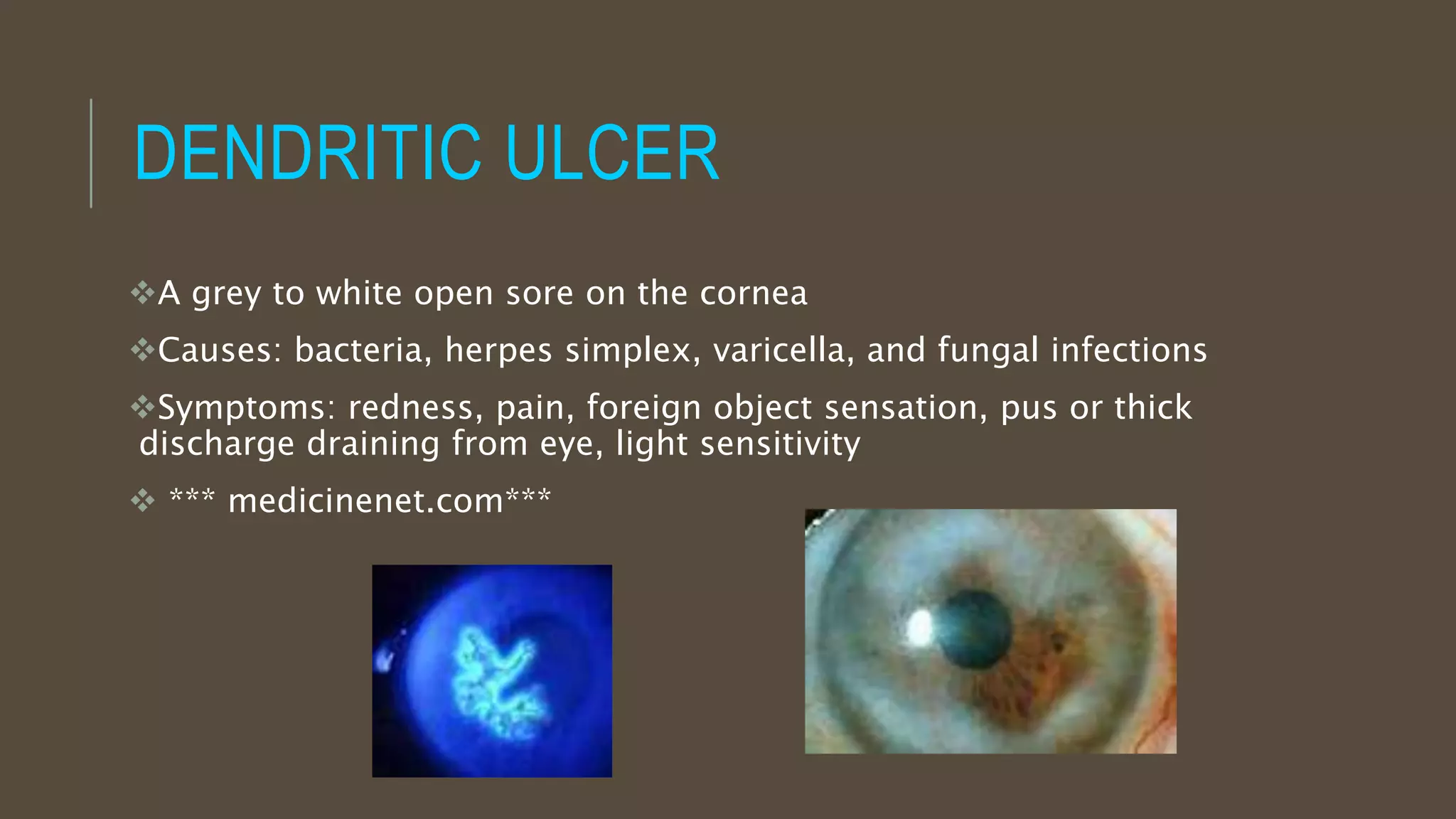 Contact Consequences 2 | PPT