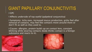 Contact Consequences 2 | PPT