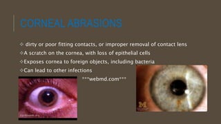 Contact Consequences 2 | PPT