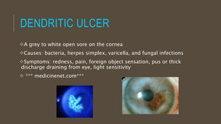 Contact Consequences 2 | PPT