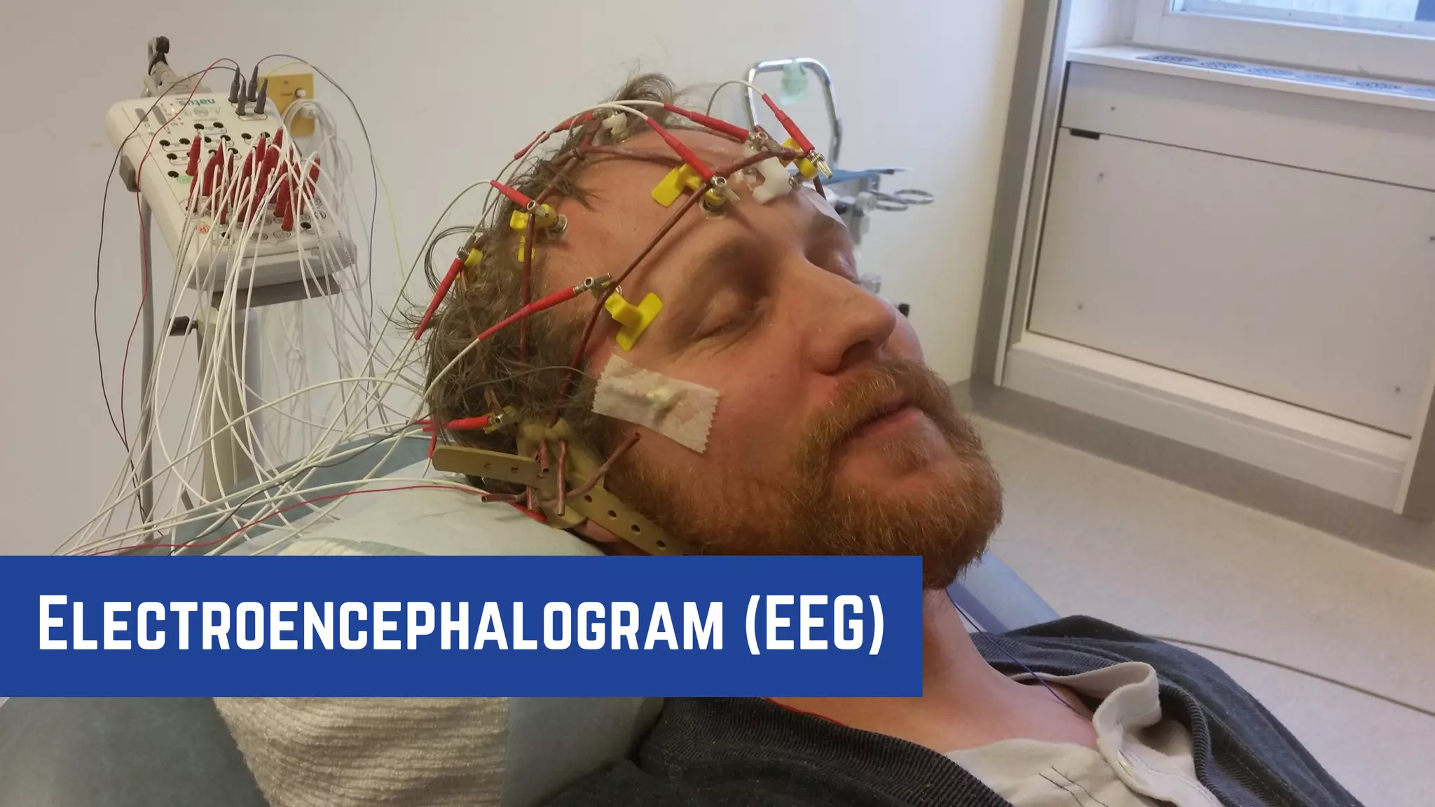 7 Diagnostic Tests For Neurology | PDF