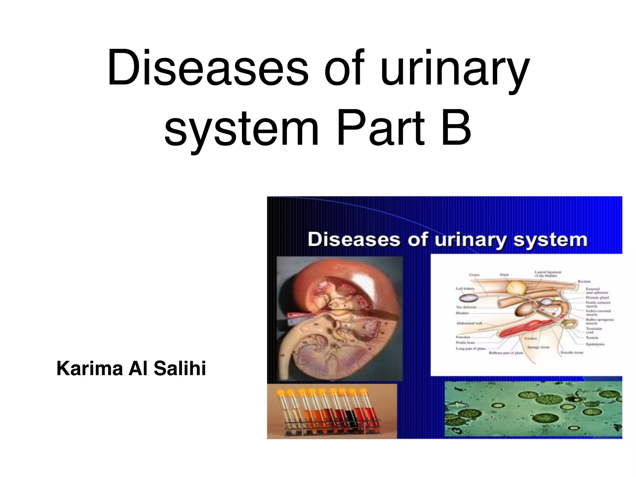 7 diseases of urinary system part b | PPT