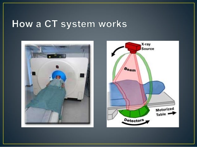 Ct scan