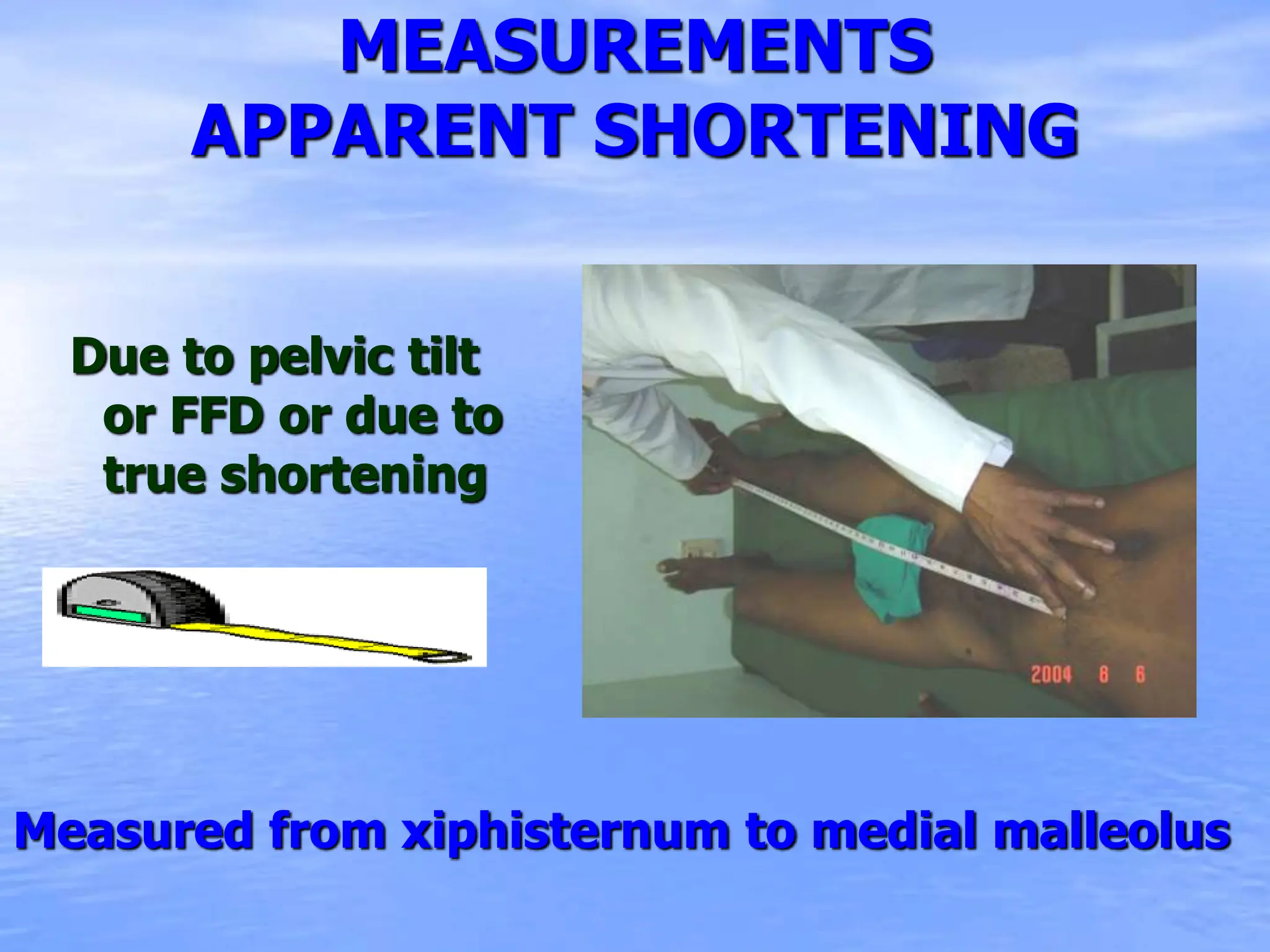 7) EXAMINATION OF THE HIP PGLC24 BHUJ by Dr.Vijay Sata Sir.pptx