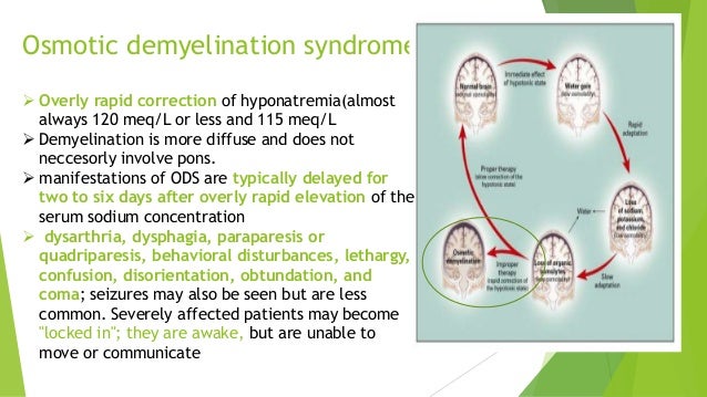 hyponatremia -my prensentation