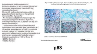IHC Markers and Antibodies | PPTX