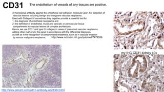 IHC Markers and Antibodies | PPTX