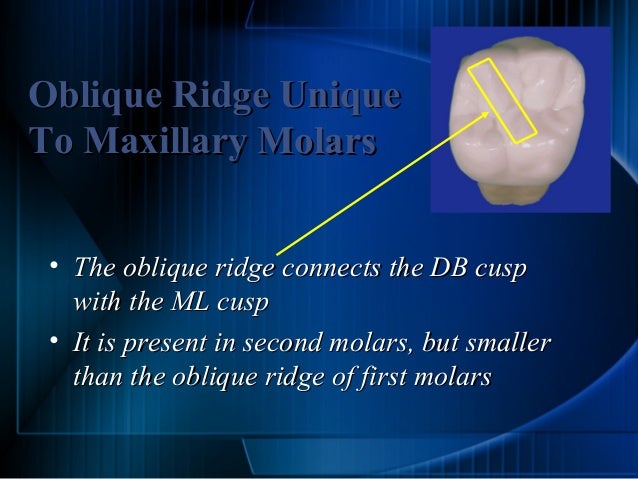 Oblique Ridge Maxillary Molars JCDR 3 Cusp Molar, Missing Cusp, Mini