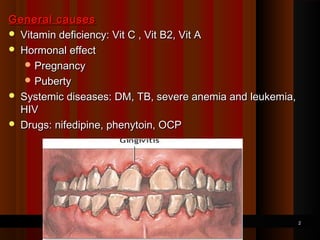 7gingivitis | PPT