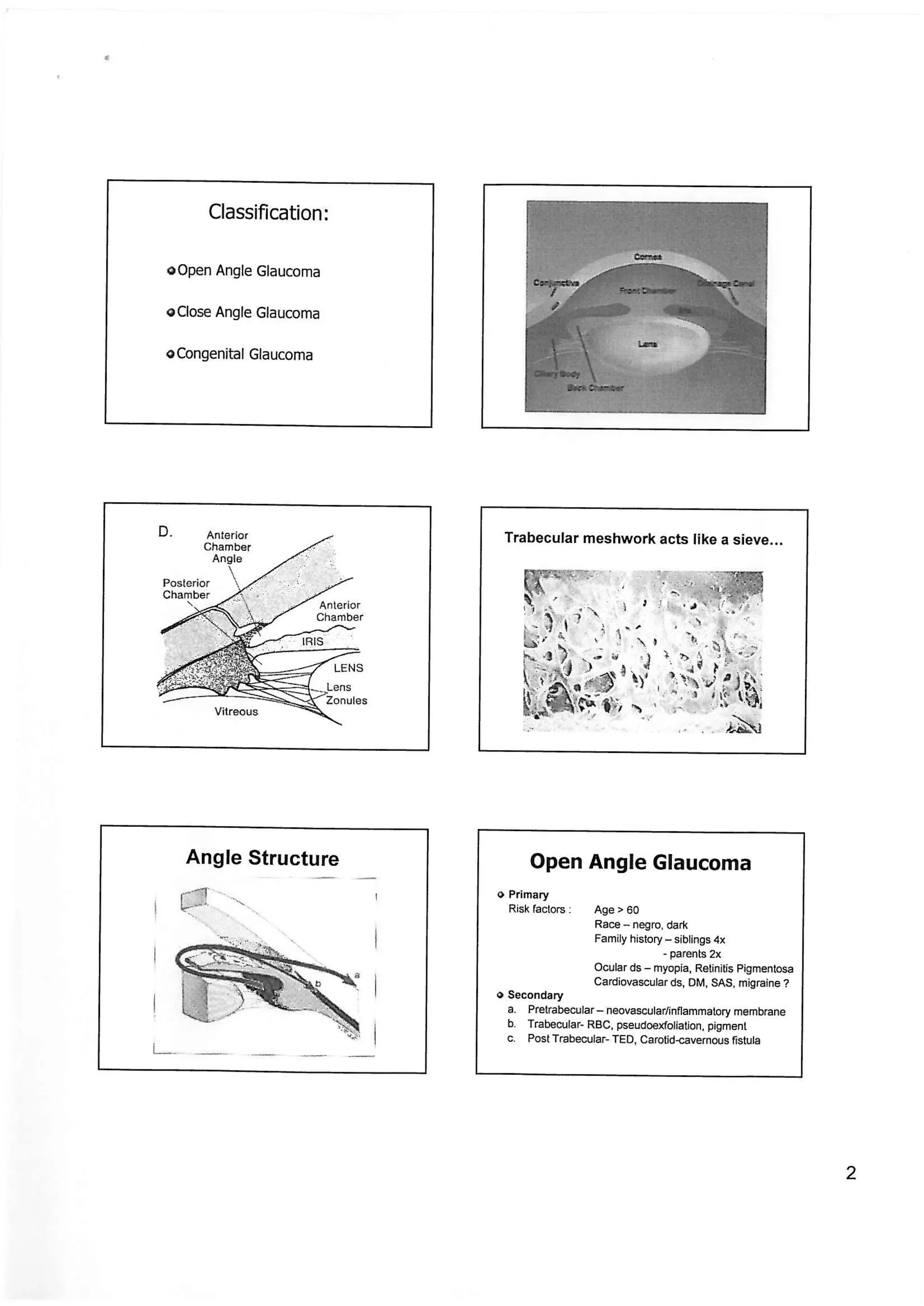 Glaucoma and management | PDF