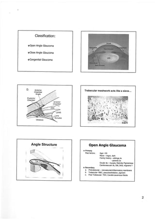 Glaucoma and management | PDF