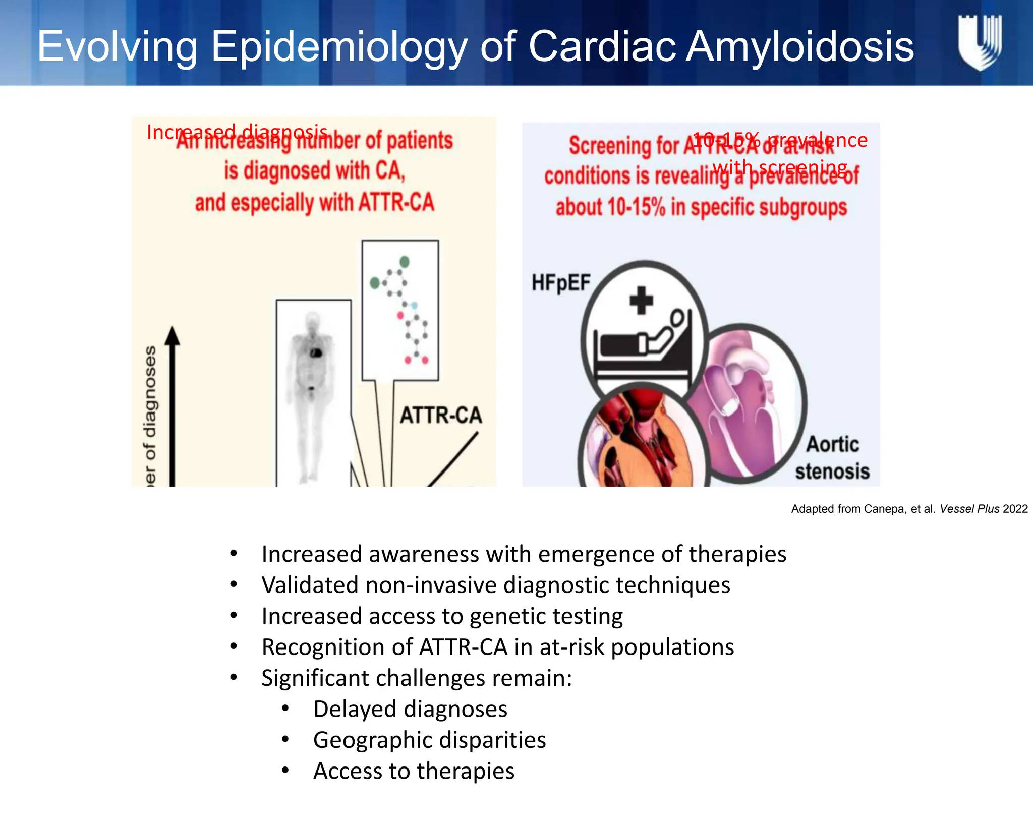 Cardiac Amyloidosis: Diagnostic & Therapeutic Approaches | PPTX
