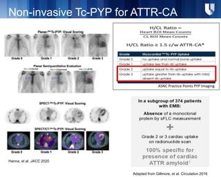 Cardiac Amyloidosis: Diagnostic & Therapeutic Approaches | PPTX