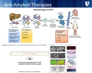 Cardiac Amyloidosis: Diagnostic & Therapeutic Approaches | PPTX