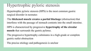Hypertrophic pyloric stenosis (HPS).pptx