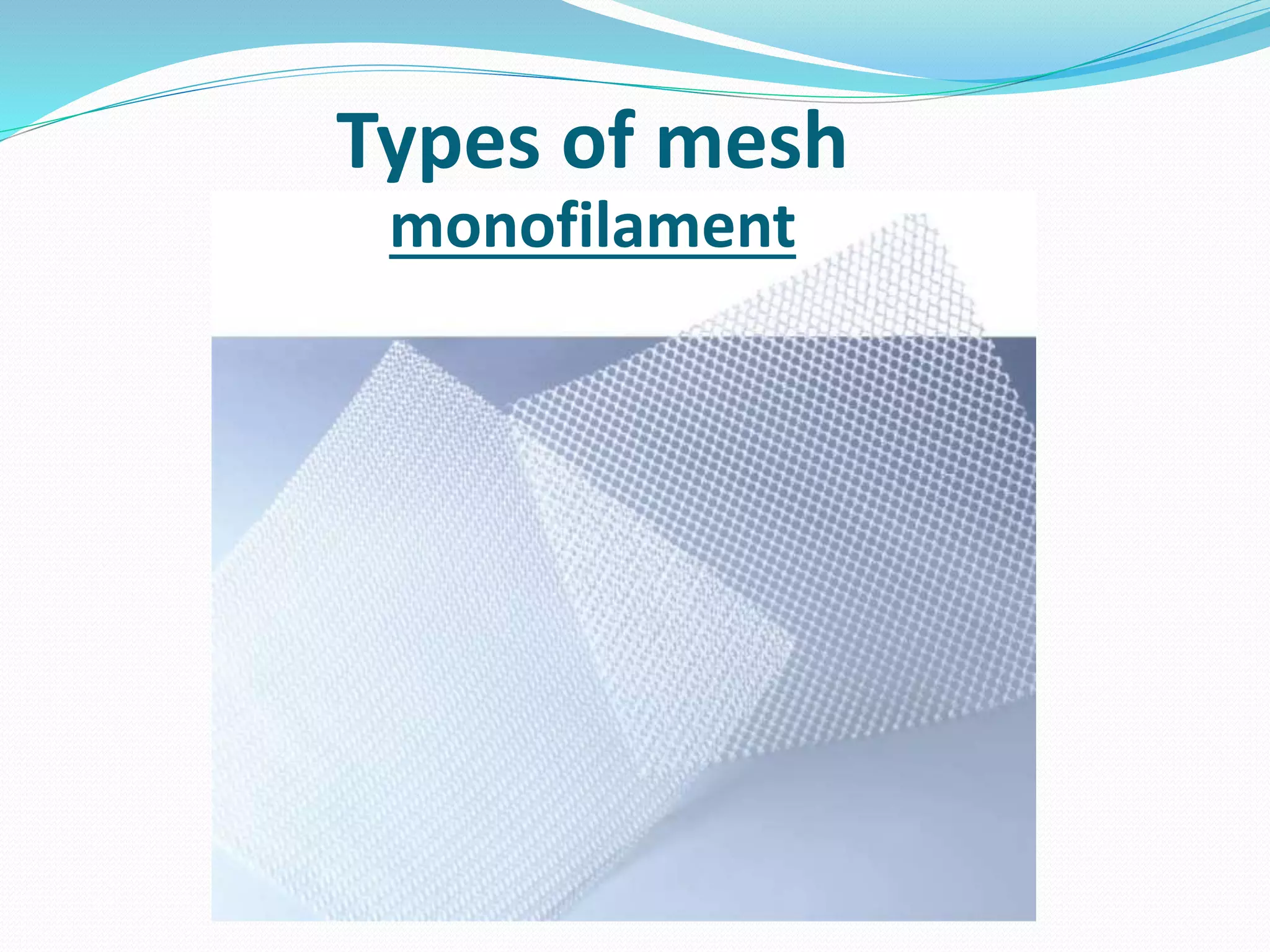 Types of mesh & complications | PPTX