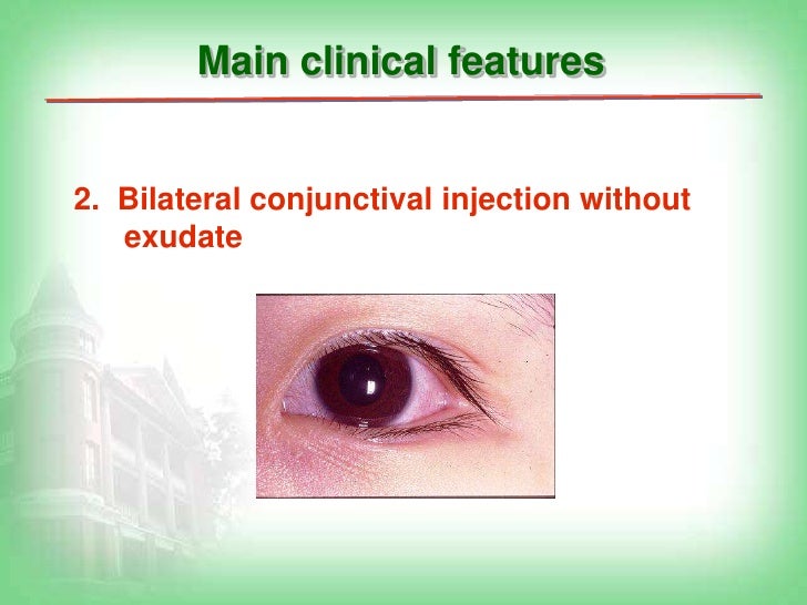 7 international students